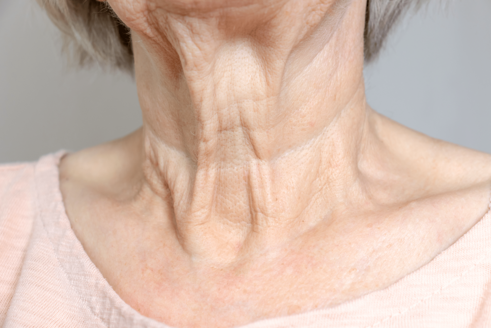 Skin Tightening - Helix Medspa